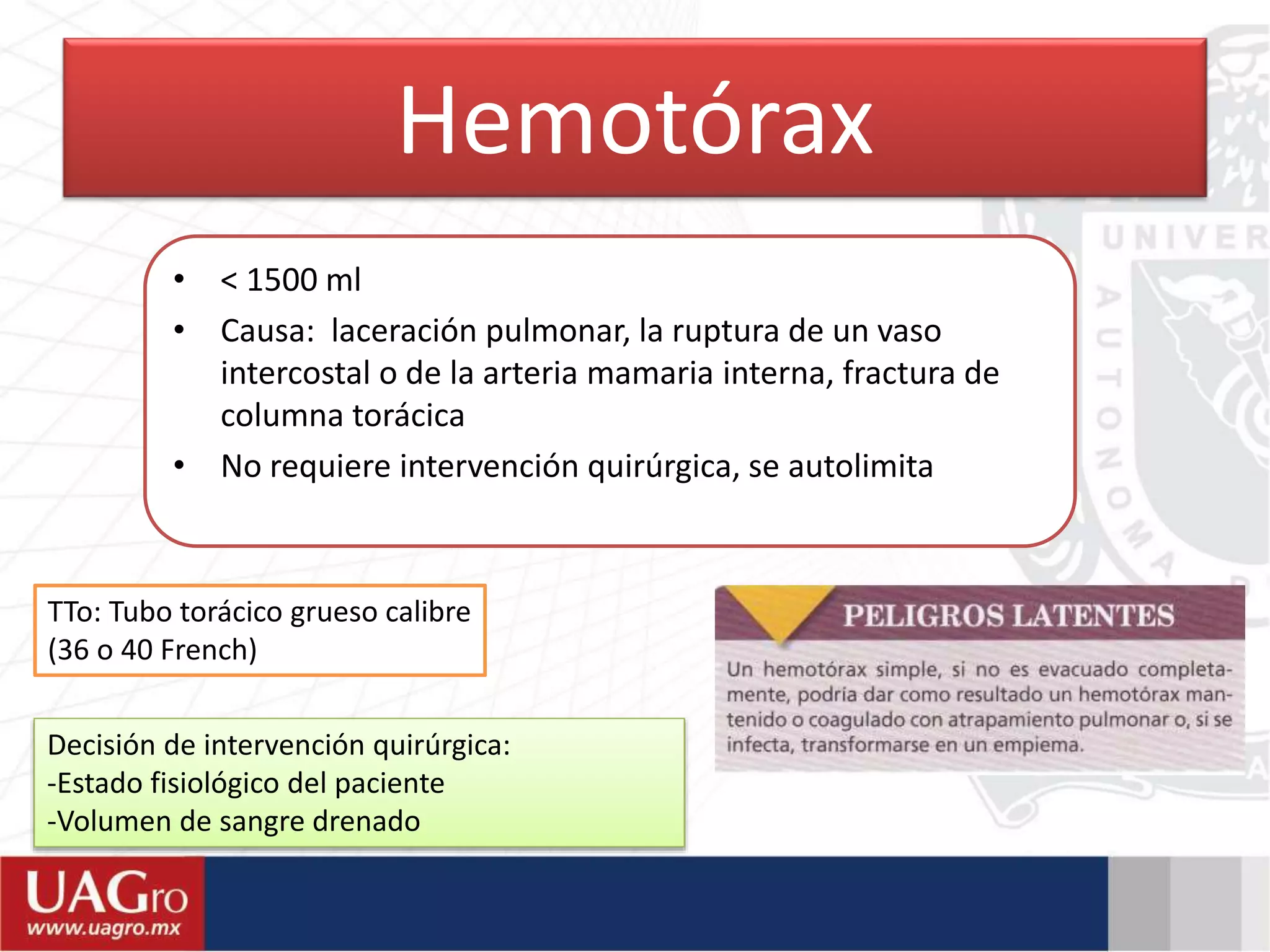 Trauma Torácico | PPTX