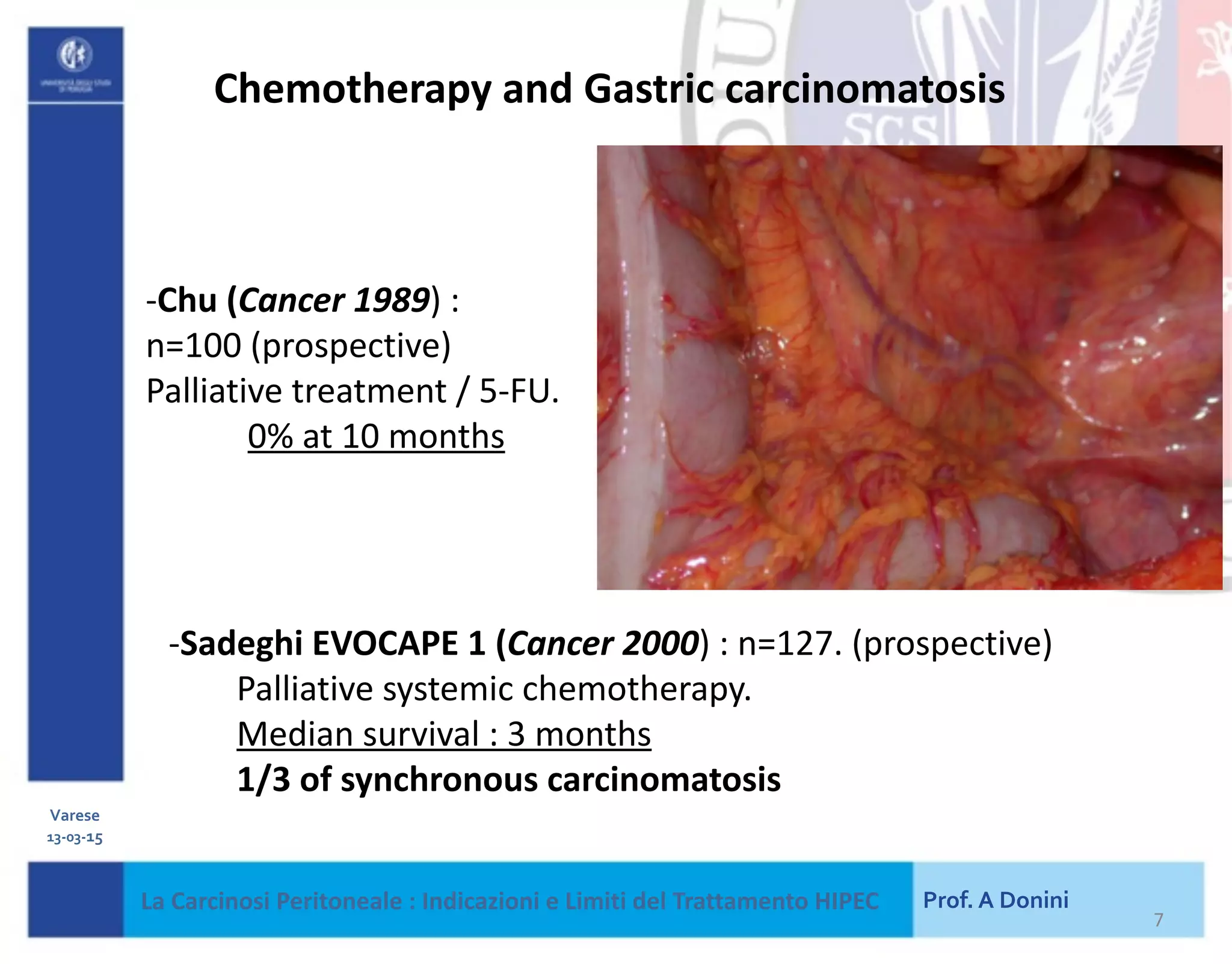 Gastric Peritoneal Carcinomatosis, HIPEC | PPT