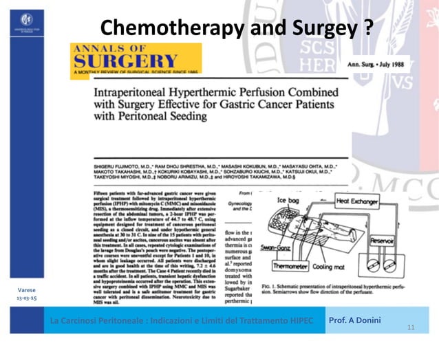 Gastric Peritoneal Carcinomatosis, HIPEC | PPT