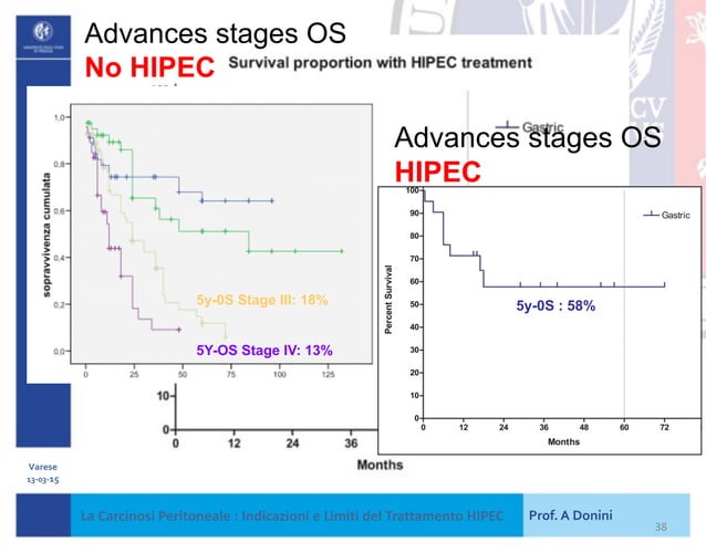 Gastric Peritoneal Carcinomatosis, HIPEC | PPT