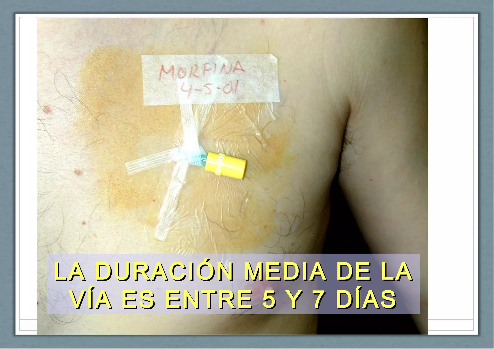 via subcutanea uso en Atención Primaria | PPT