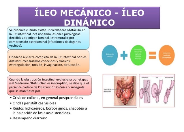 SINDROME ILEO