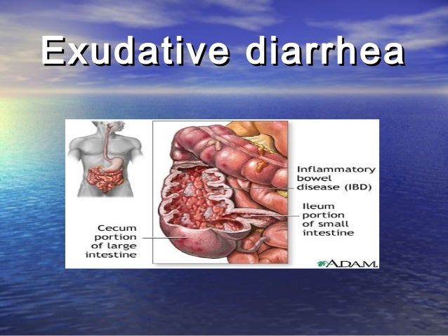 Diarrhea