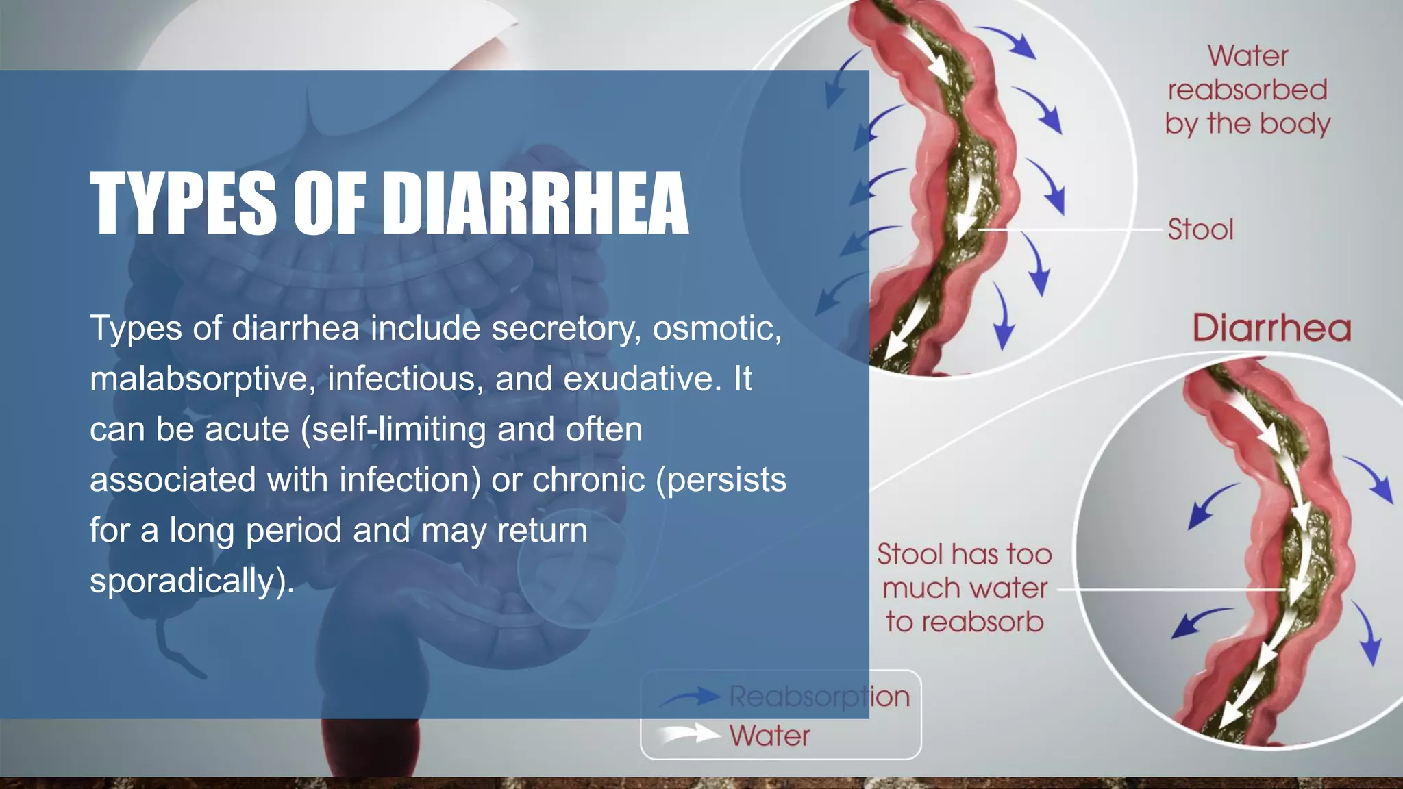 Diarrhea- easy ppt for Nurses | PDF