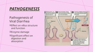 Diarrhea (symptoms, causes, organisms, types, treatment) | PPTX