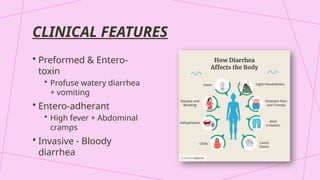 Diarrhea (symptoms, causes, organisms, types, treatment) | PPTX