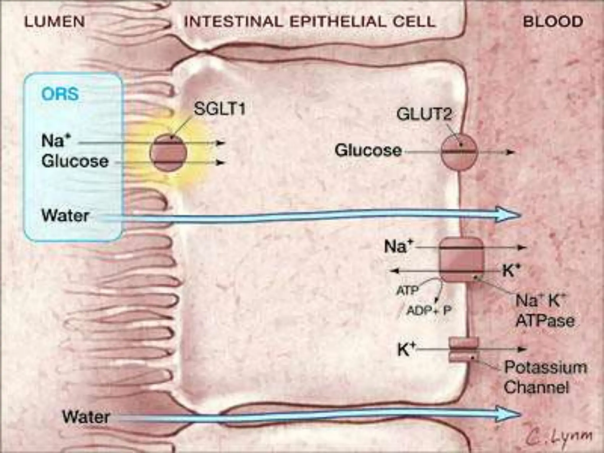 Acute gastroenteritis/Diarrhea Clinical.ppt