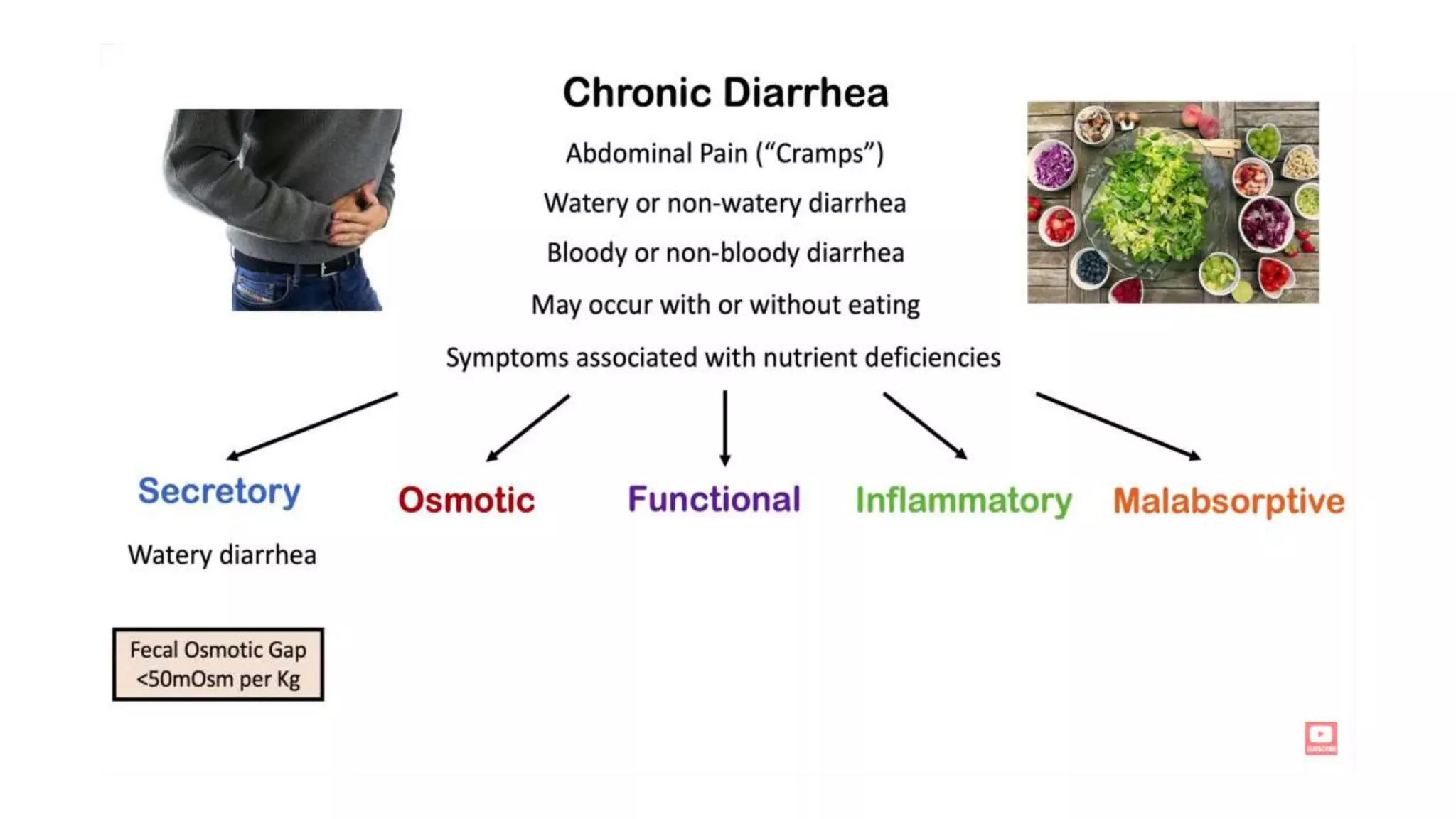 diarrhea etio-pathogenesis.pptx