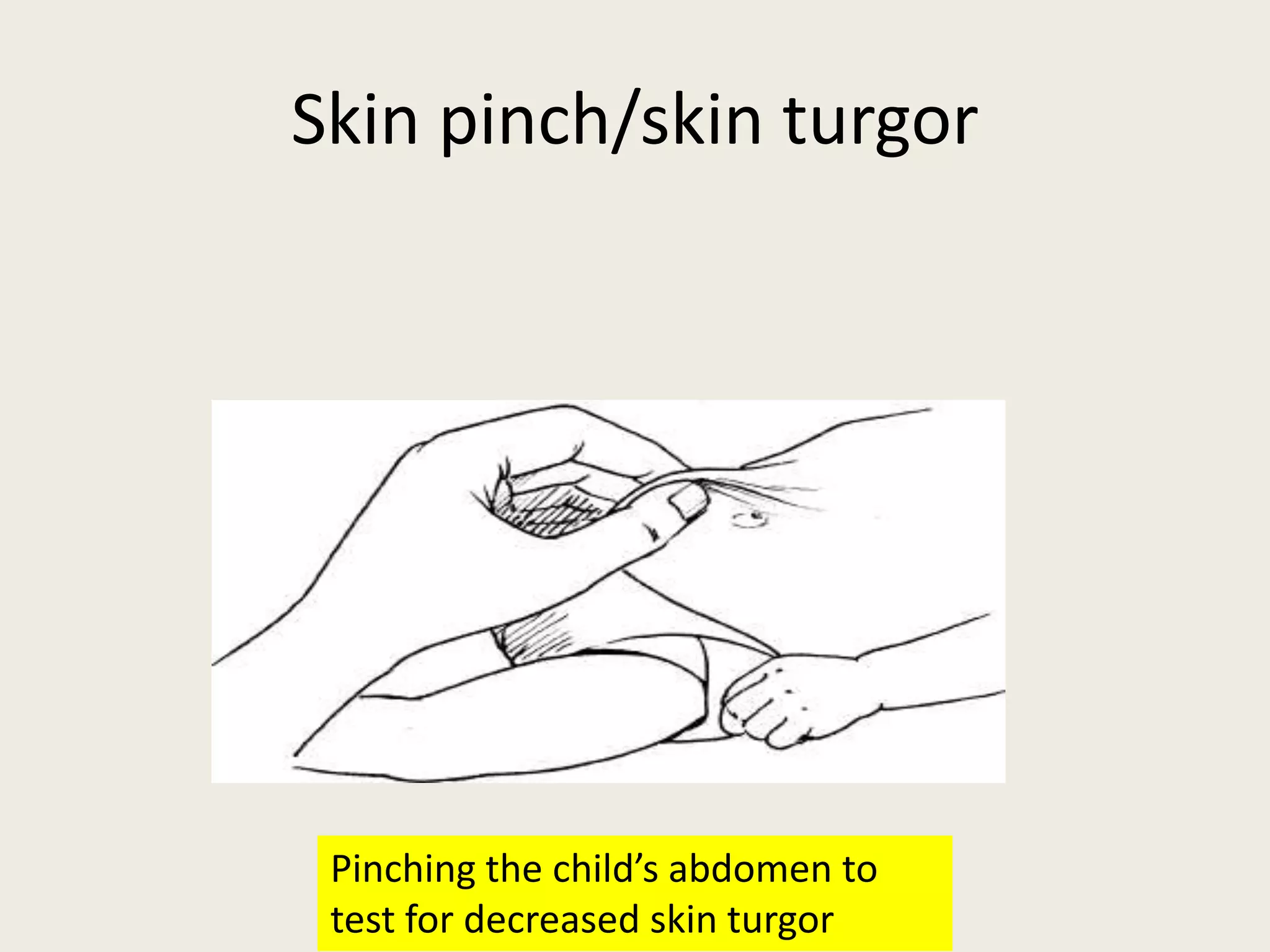 Diarrheal diseases in children 4th year | PPTX