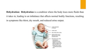 DIARRHOEA & DEHYDRATION: NURSING MANAGEMENT.pptx