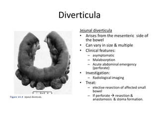 Diasease of small intestine | PPTX