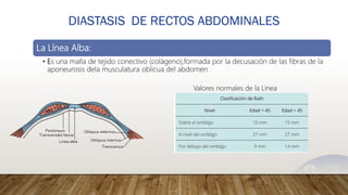 diastasis de rectos.pptx
