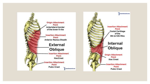 Diastasis recti.pptx | Medical Health
