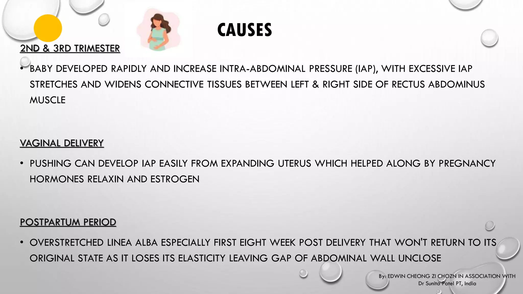 DIASTASIS RECTI - Edwin Cheong Zi Chozn.pdf