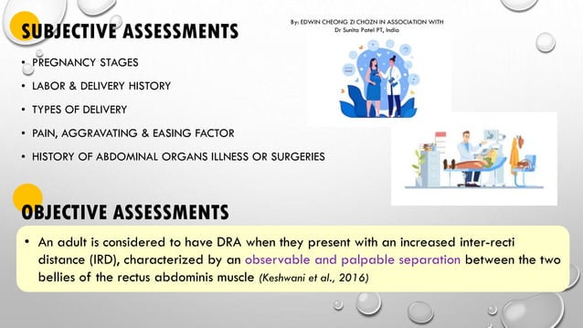 DIASTASIS RECTI - Edwin Cheong Zi Chozn.pdf