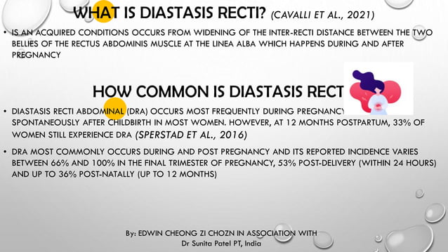 DIASTASIS RECTI - Edwin Cheong Zi Chozn.pdf