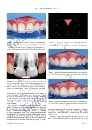 Diastema Closure With Direct Composite.pdf