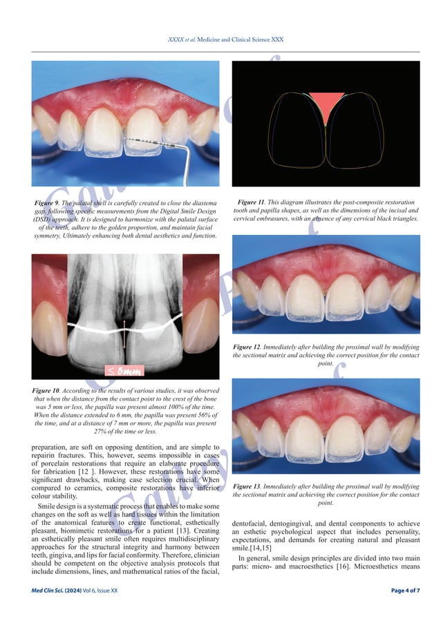 Diastema Closure With Direct Composite.pdf