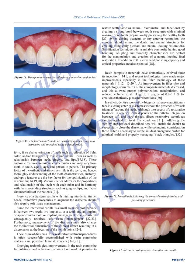 Diastema Closure With Direct Composite.pdf