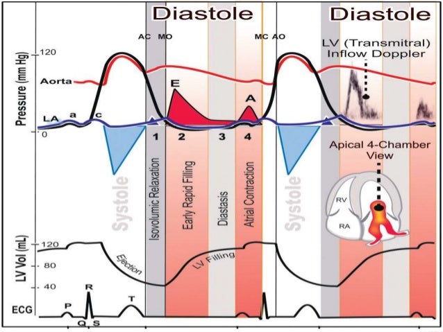 Lv Diastolic Dysfunction Ase :: Keweenaw Bay Indian Community