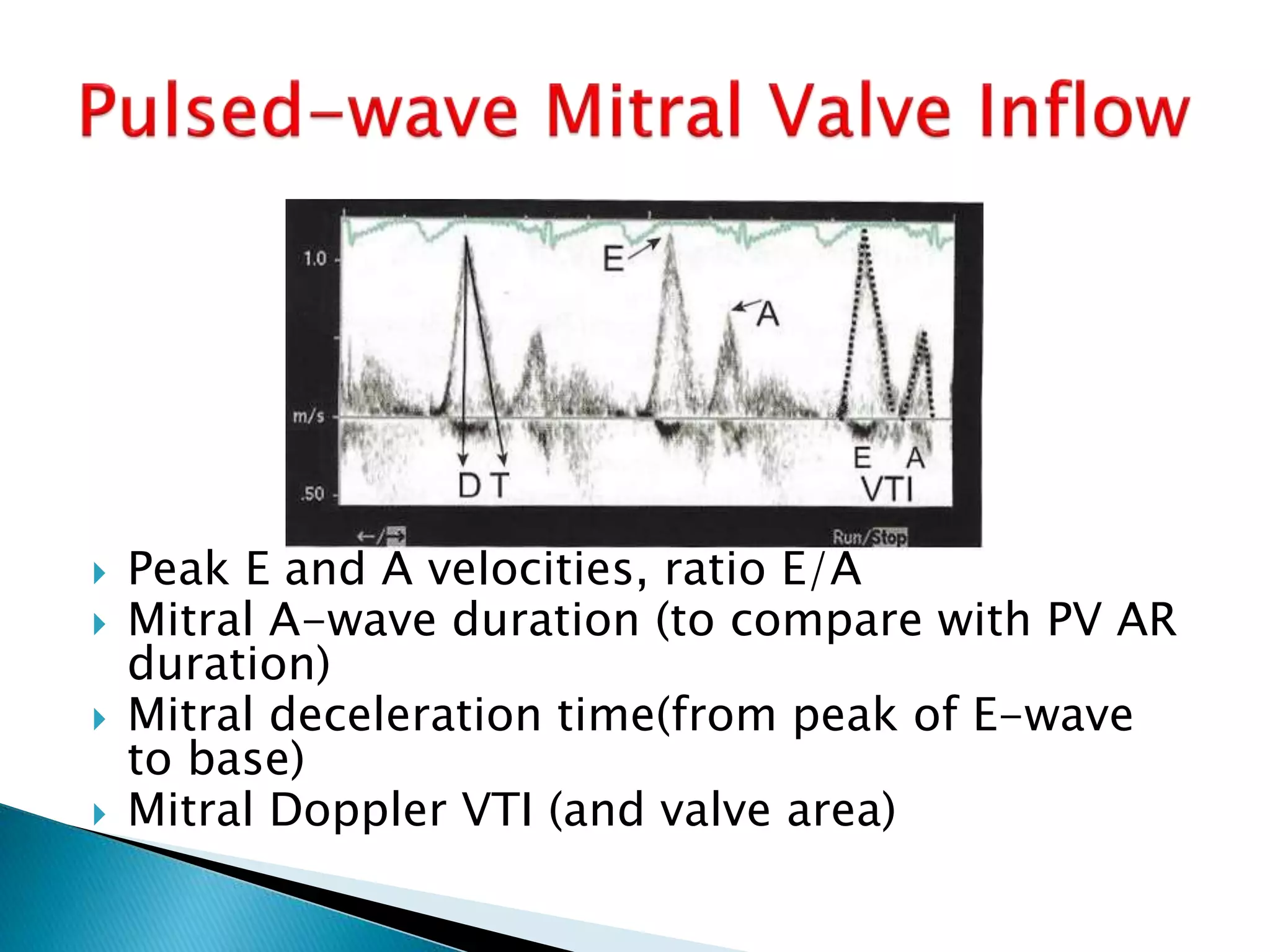 ECHOCARDIOGRAPHIC EVALUATION of LEFT VENTRICULAR DIASTOLIC FUNCTION ...