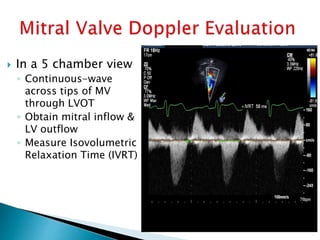 ECHOCARDIOGRAPHIC EVALUATION of LEFT VENTRICULAR DIASTOLIC FUNCTION ...