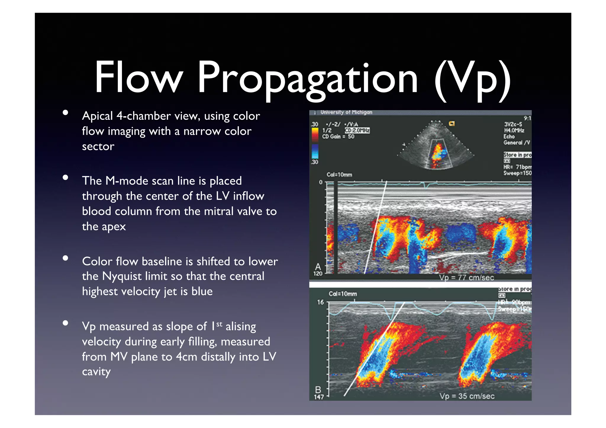 Echocardiographic Evaluation of LV Diastolic Function | PDF