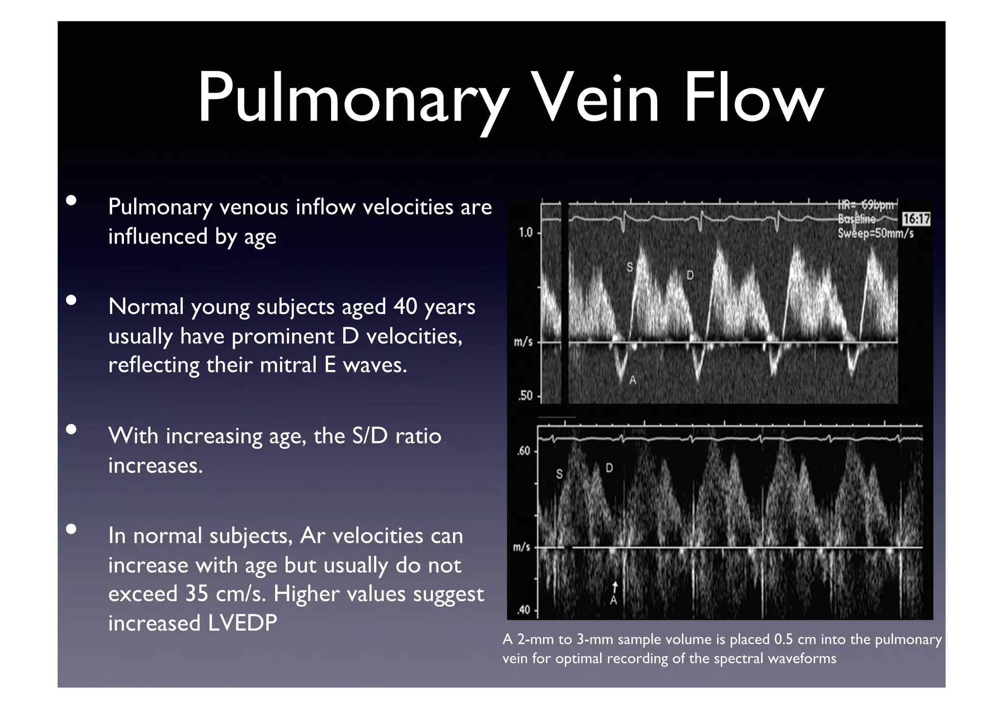Echocardiographic Evaluation of LV Diastolic Function | PDF