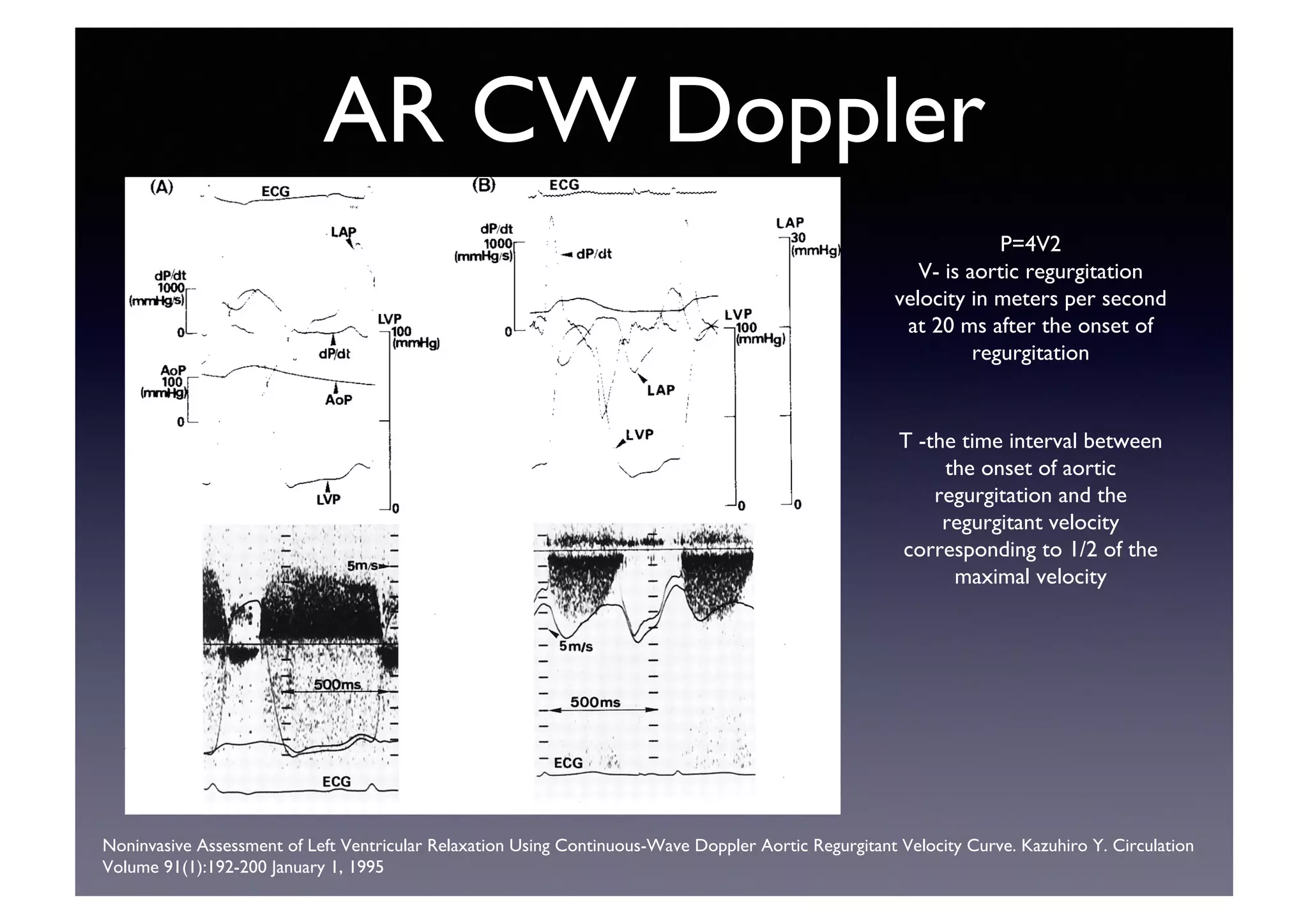 Echocardiographic Evaluation of LV Diastolic Function | PDF