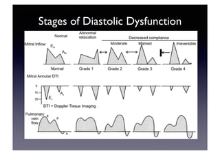 Echocardiographic Evaluation of LV Diastolic Function | PDF