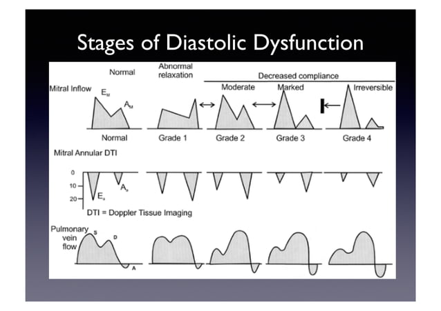 Echocardiographic Evaluation of LV Diastolic Function | PDF