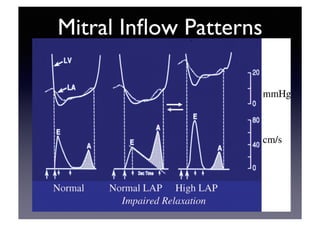 Echocardiographic Evaluation of LV Diastolic Function | PDF