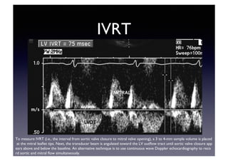 Echocardiographic Evaluation of LV Diastolic Function | PPT