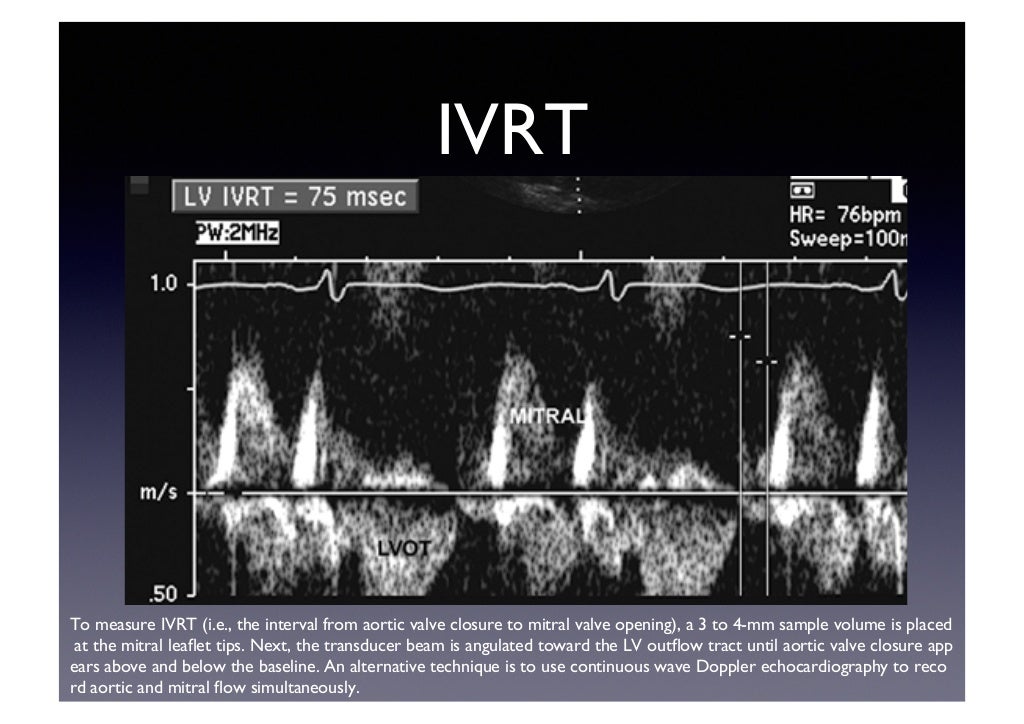 Echocardiographic Evaluation Of Lv Diastolic Function