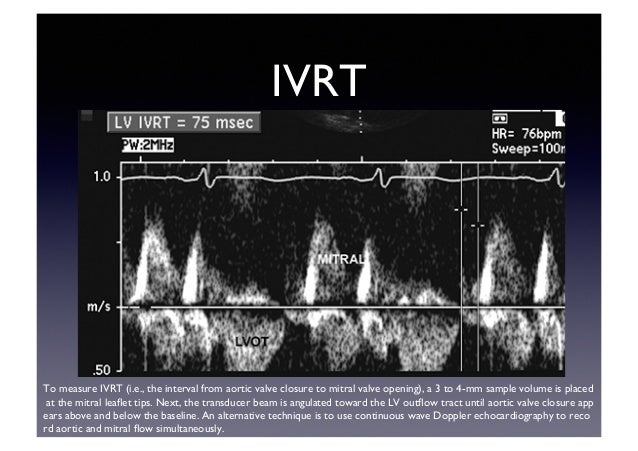 Echocardiographic Evaluation Of Lv Diastolic Function
