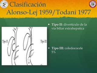 Diataciones quisticas de la via biliar | PPTX