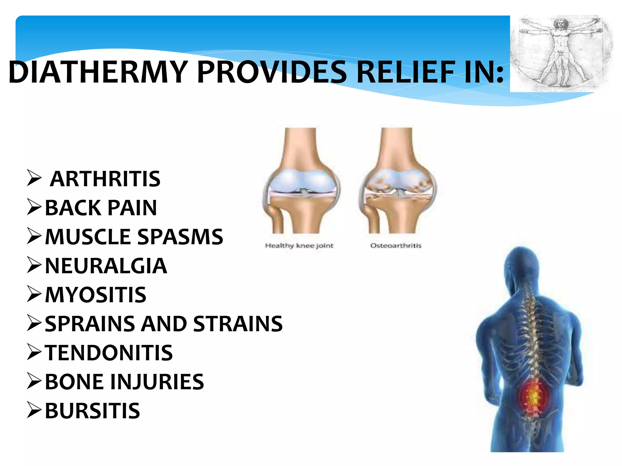 Diathermy | PPTX