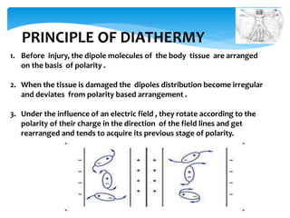 Diathermy | PPTX