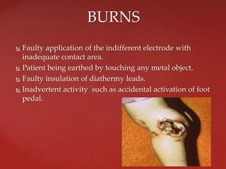Diathermy | PPTX