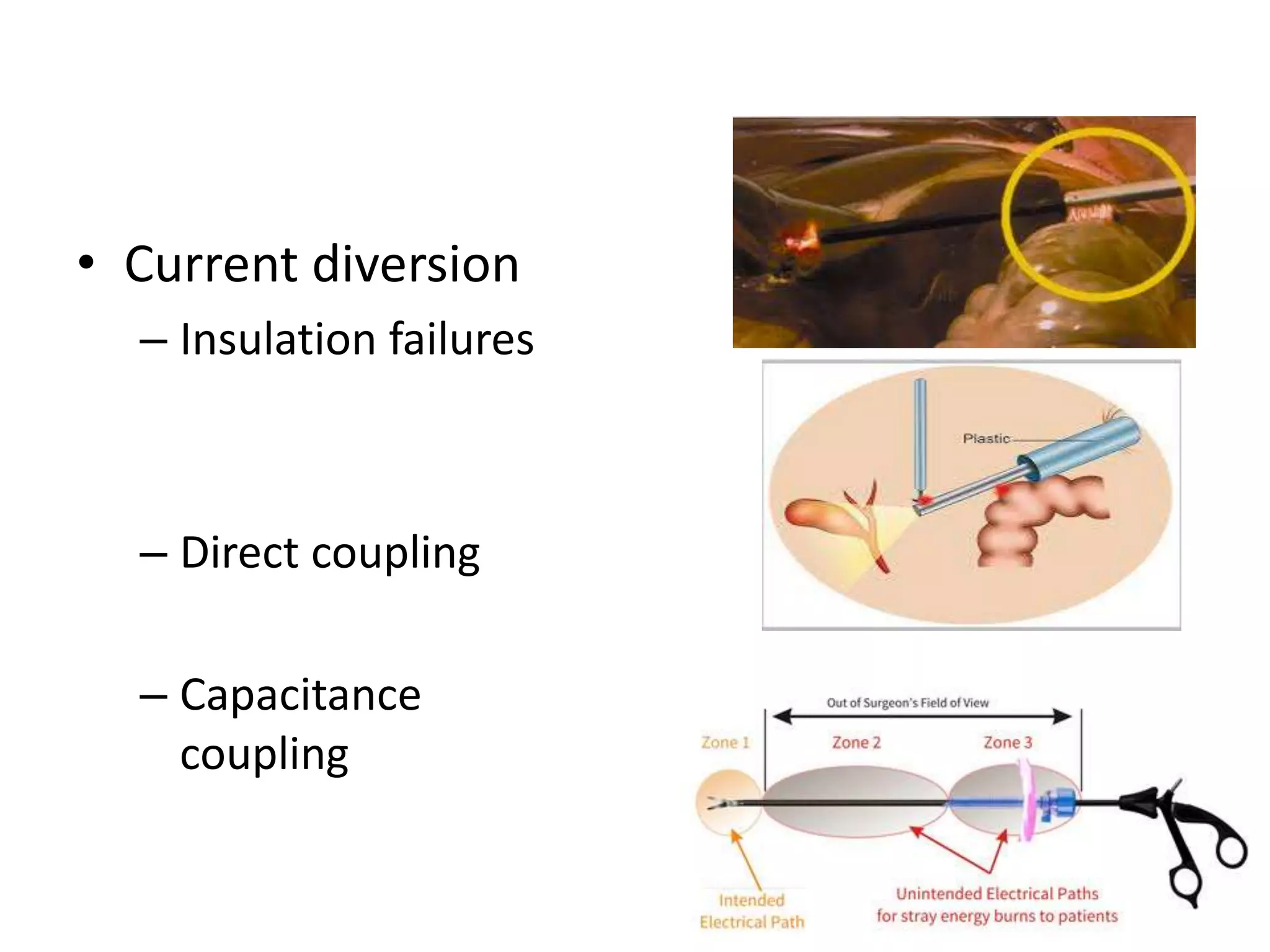 Diathermy in surgery | PPTX