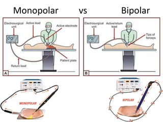 Diathermy in surgery | PPTX