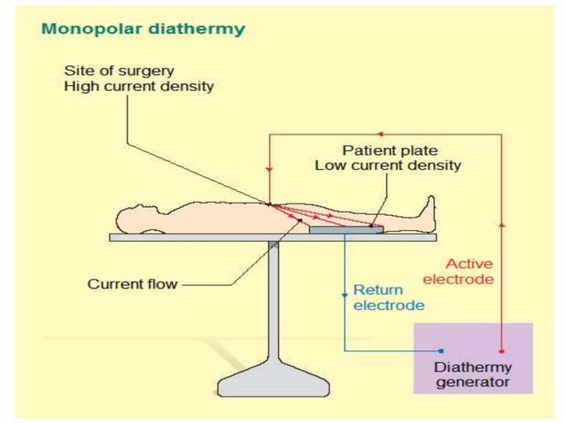 Diathermy and fire hazard in operating theatre | PPTX | First Aid ...