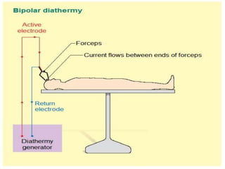 Diathermy and fire hazard in operating theatre | PPTX