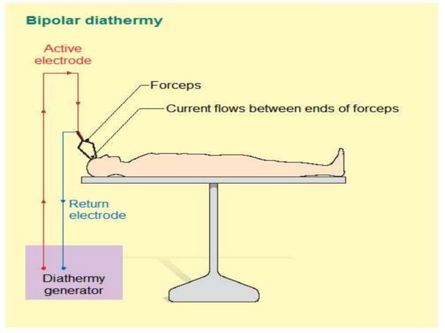 Diathermy and fire hazard in operating theatre | PPTX | First Aid ...