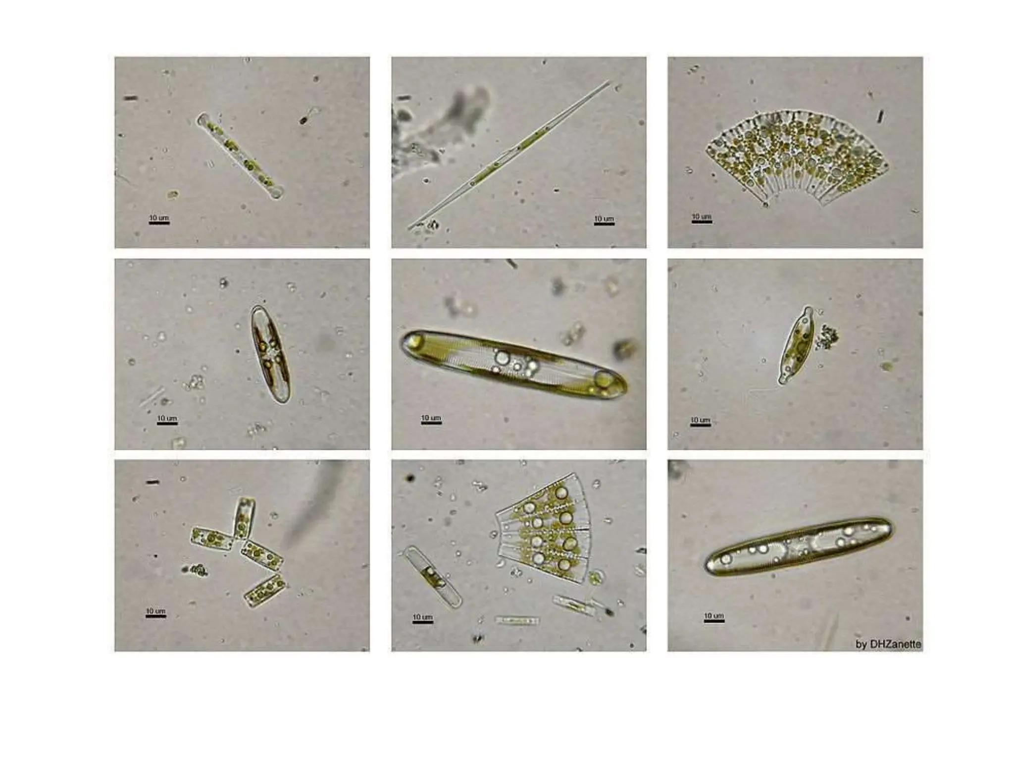 DIATOM EXAMINATION, in forensic science in drowning cases | PPTX