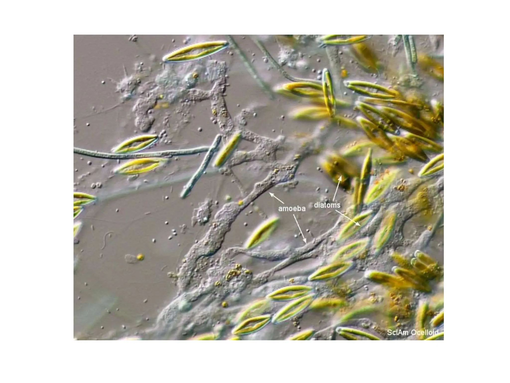 DIATOM EXAMINATION, in forensic science in drowning cases | PPTX