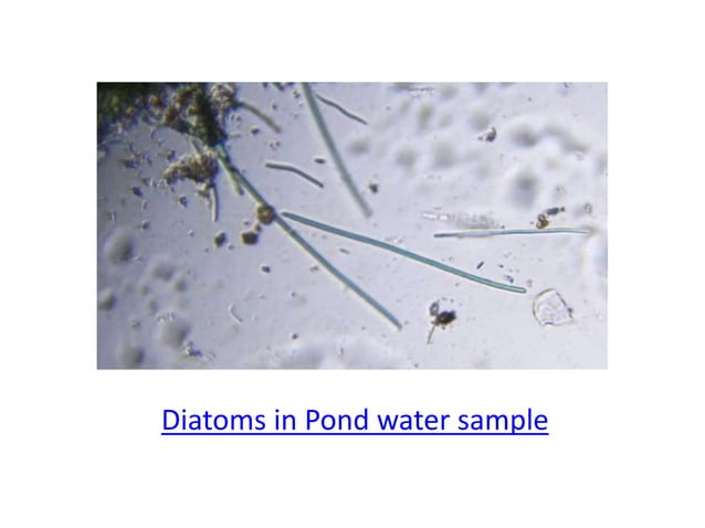 DIATOM EXAMINATION, in forensic science in drowning cases | PPTX