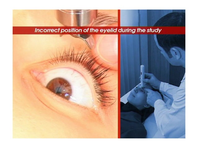 Diaton Tonometer aka Glaucoma Eye Test Images / Photos | PPT