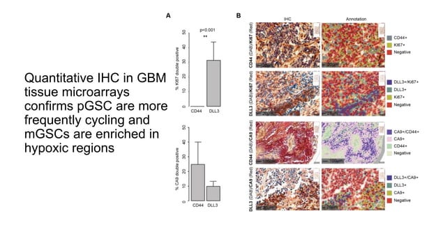 A draft single-cell atlas of human glioma | PPT