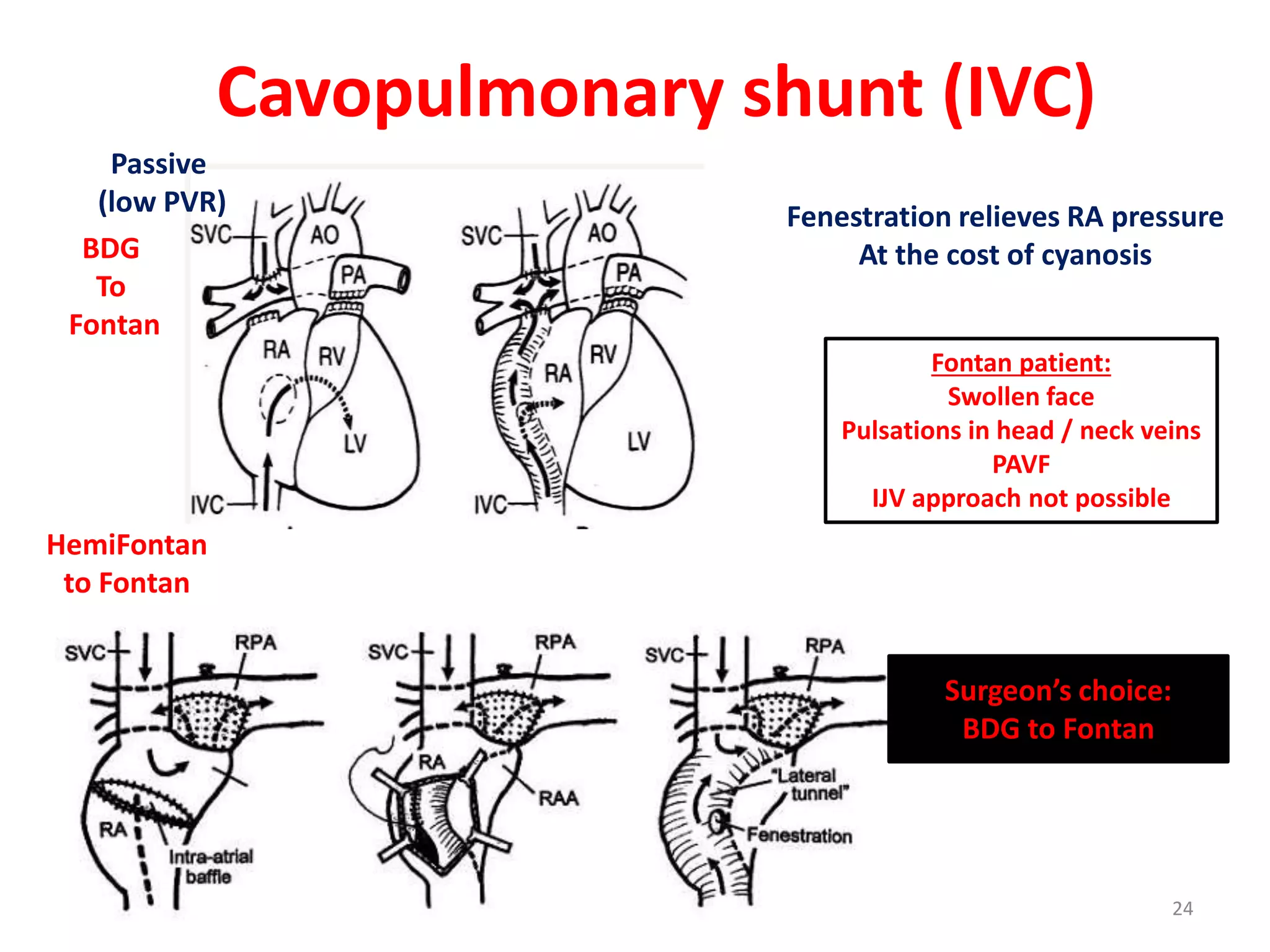 surgical approach of cyanotic congenital heart disease | PPTX
